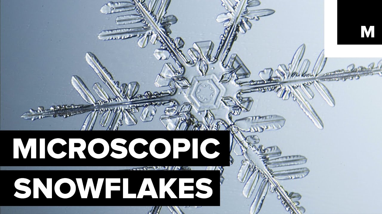 Snowflakes Under Microscope