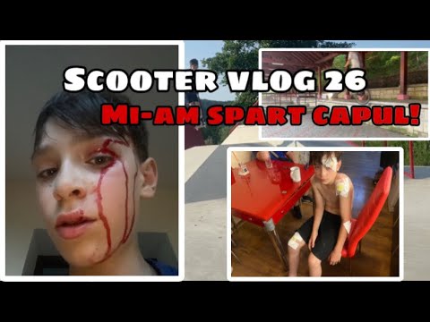 Mi-am spart arcada‼️| Scooter vlog 26 - YouTube