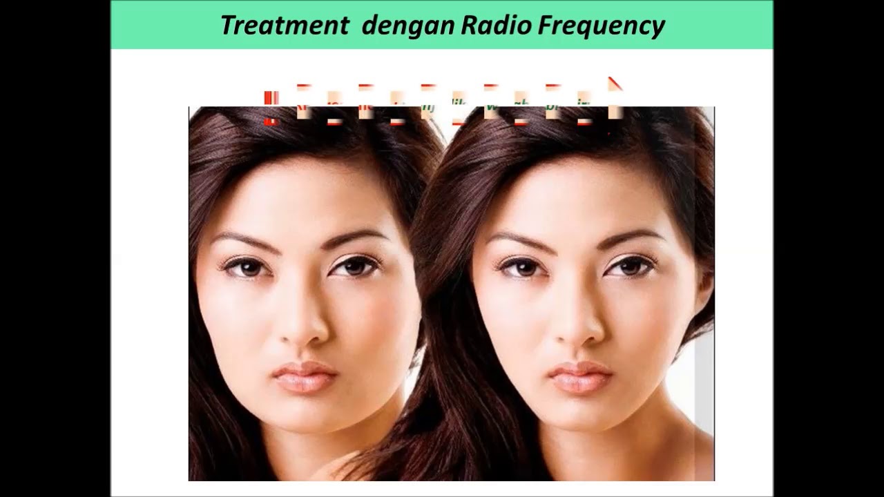 NADISA SKINCARE KLINIK KECANTIKAN TERBAIK DI BEKASI - YouTube