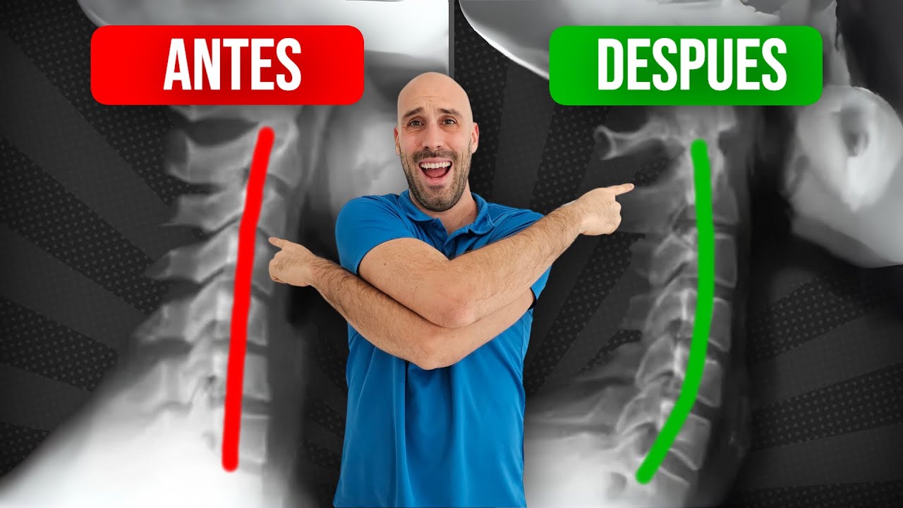RECTIFICACIÓN CERVICAL rutina de EJERCICIOS para CORREGIRLA - YouTube