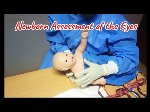 Newborn assessment: The Eyes - YouTube
