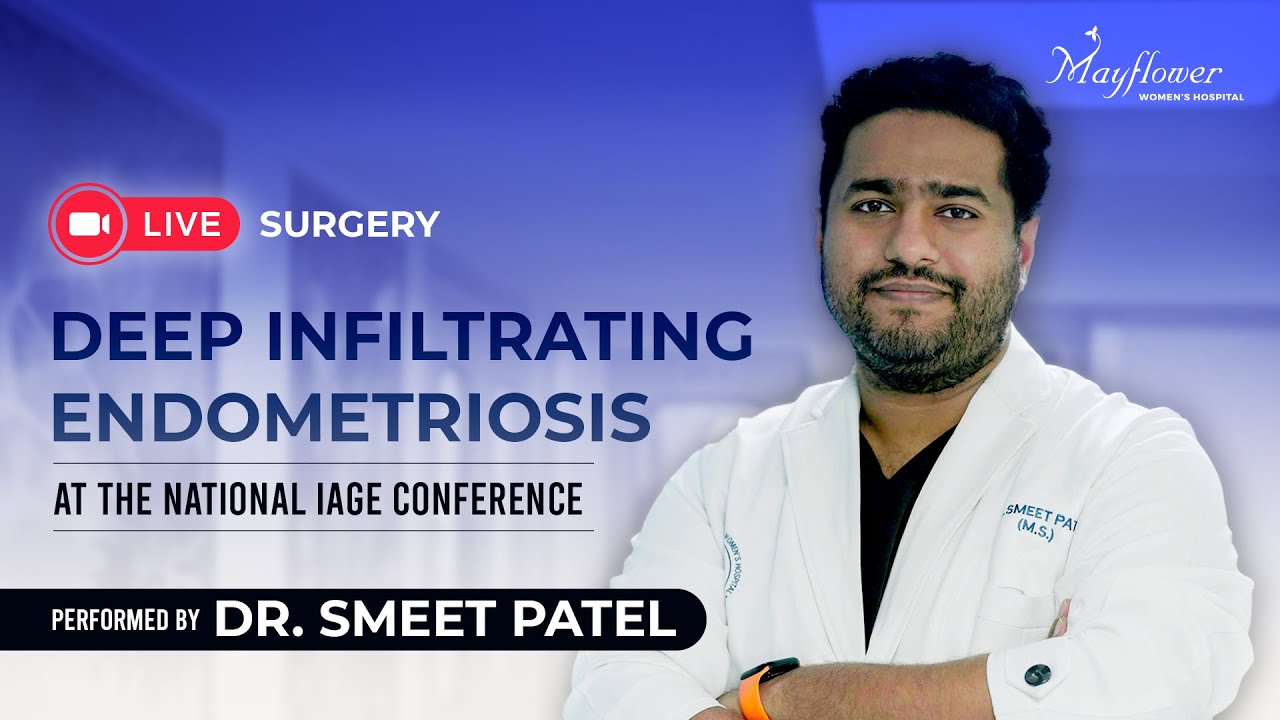 Deep Infiltrating Endometriosis at National IAGE Conference | Dr. Smeet ...
