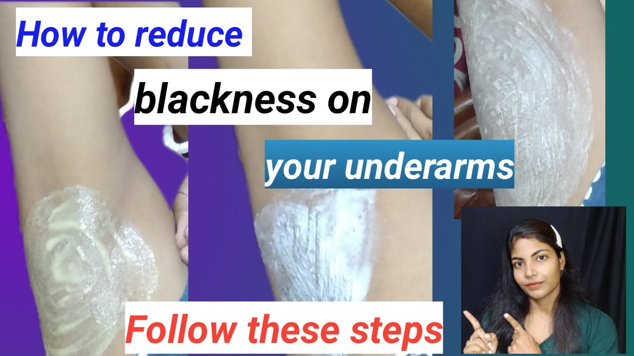 How to get rid of your underarms blackness at home|| underarms ...