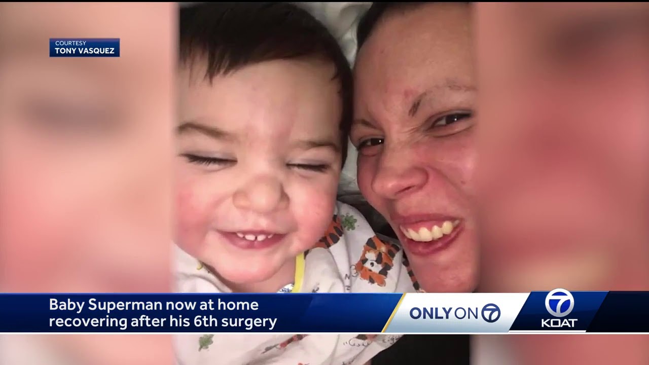 Baby Superman recovering after 6th surgery - YouTube
