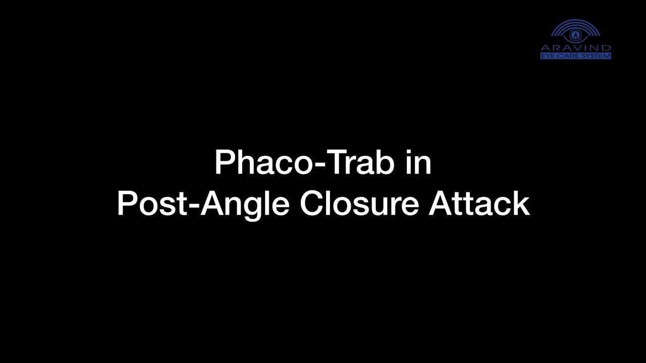 Phaco-Trab in Post-Angle Closure Attack - YouTube