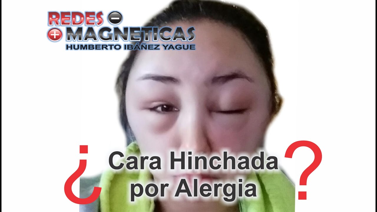 CARA INCHADA CURADA CON REDES MAGNÉTICAS - YouTube