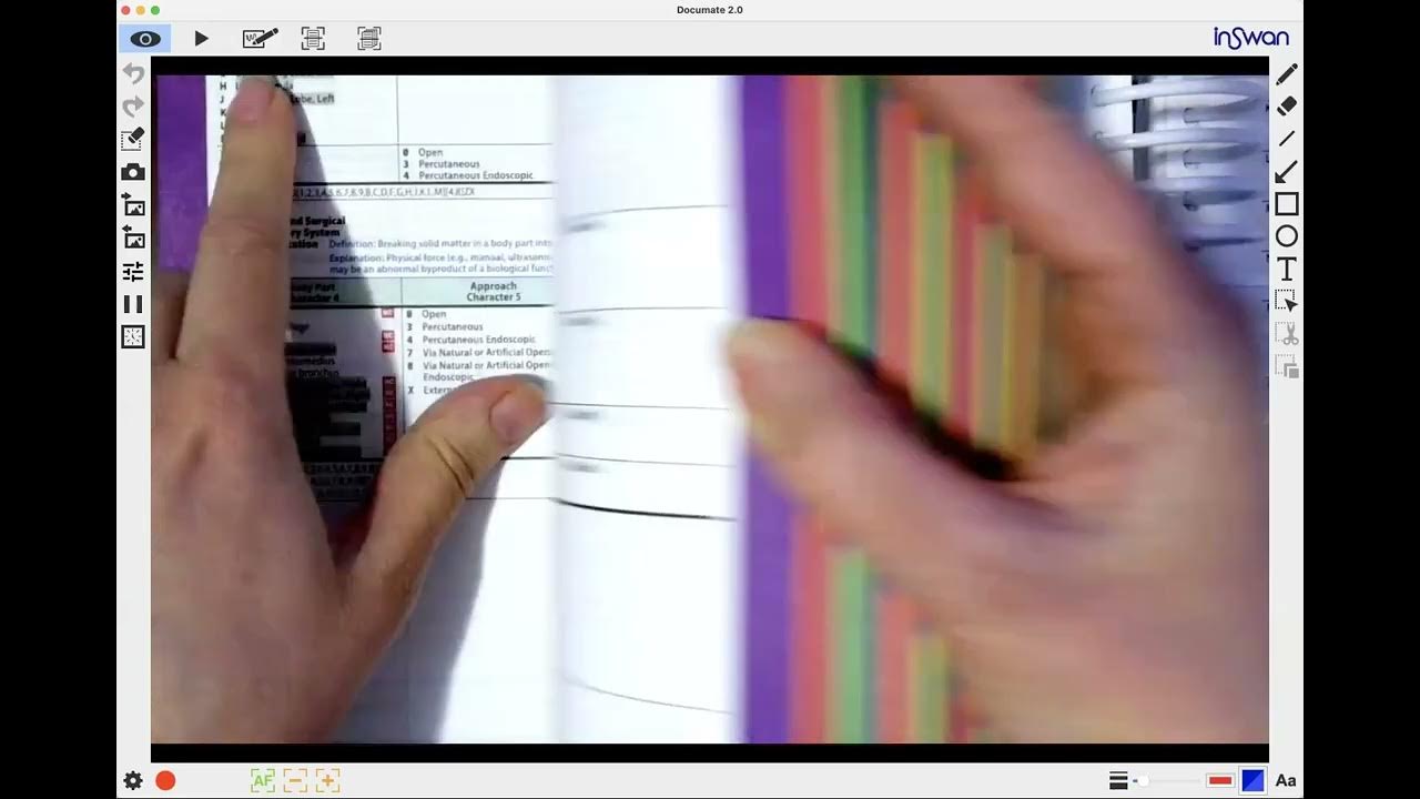 ICD-10-PCS Medical and Surgical Section Root Operations - YouTube