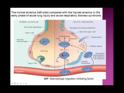 Respiratory system pathology - YouTube