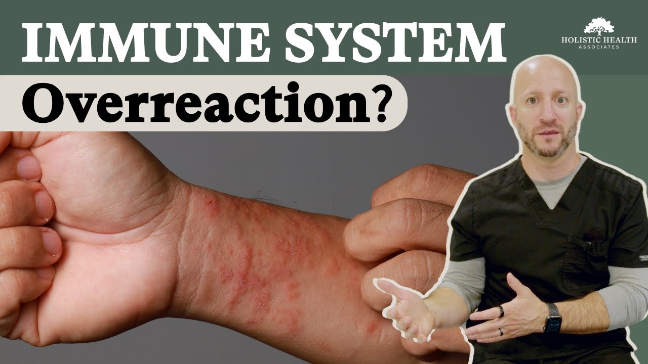 Your Immune System can Overreact - Don't Ignore These Signs! - YouTube