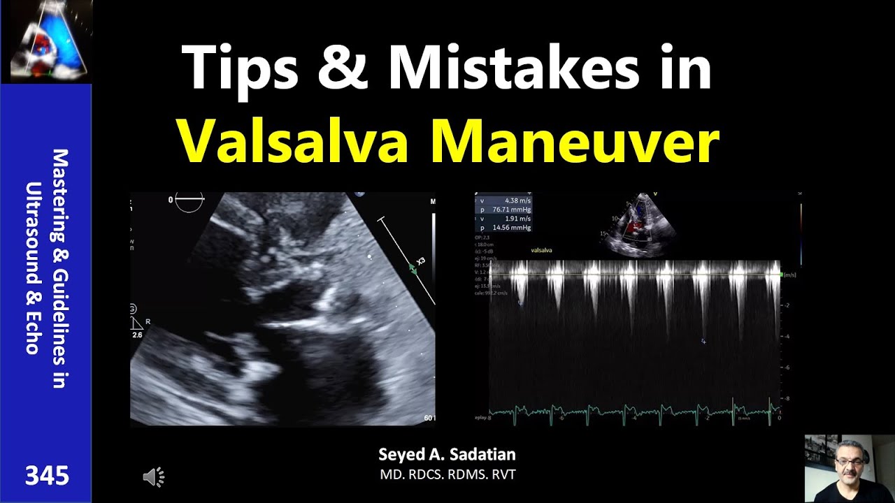 Tips & Mistakes in Valsalva Maneuver - YouTube
