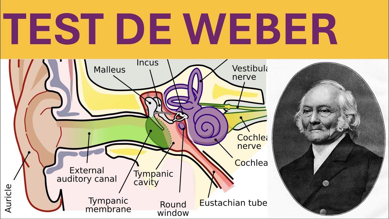 Test de Weber - YouTube