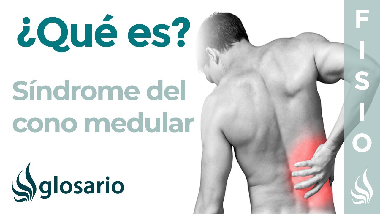 SÍNDROME del CONO MEDULAR | Qué es, síntomas, signos clínicos, causas y ...