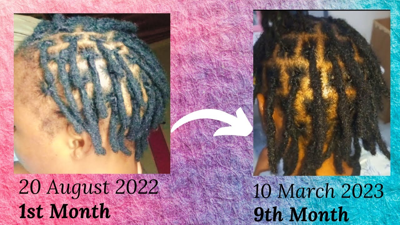 Mind blowing 9 month dreadlock journey | A Must watch and share. - YouTube