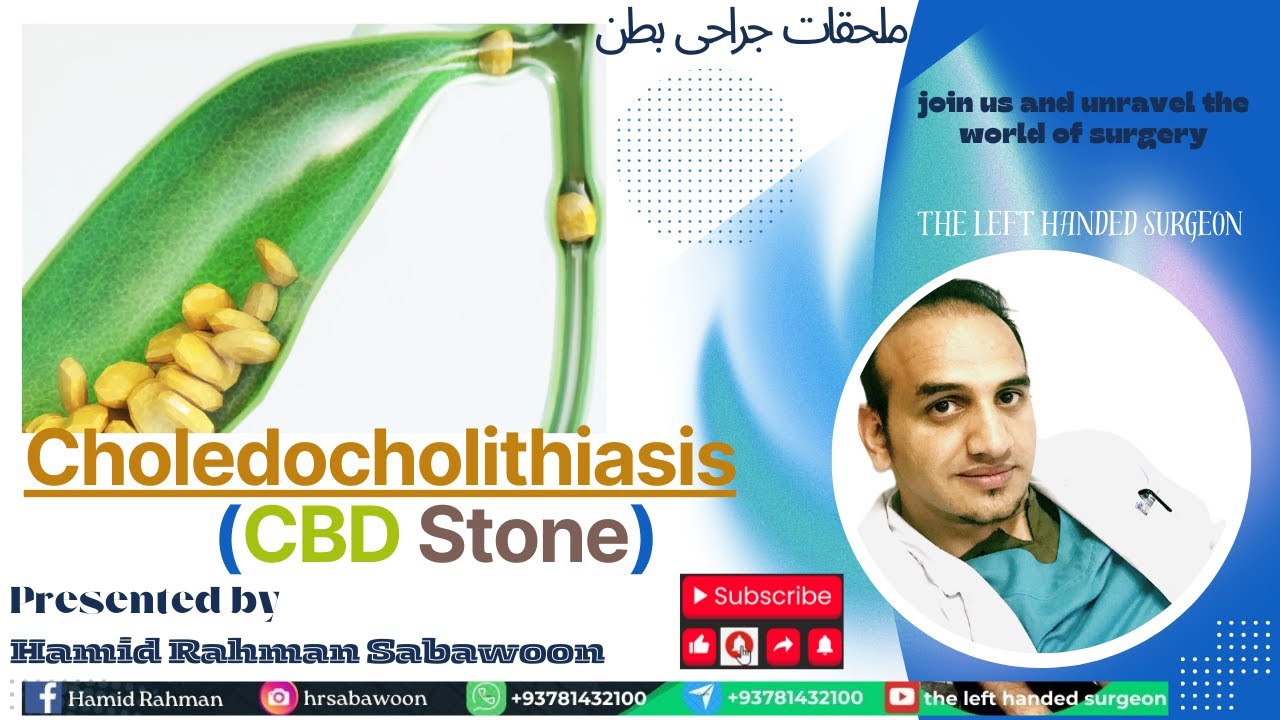 7- Choledocholithiasis (CBD Stone) - YouTube