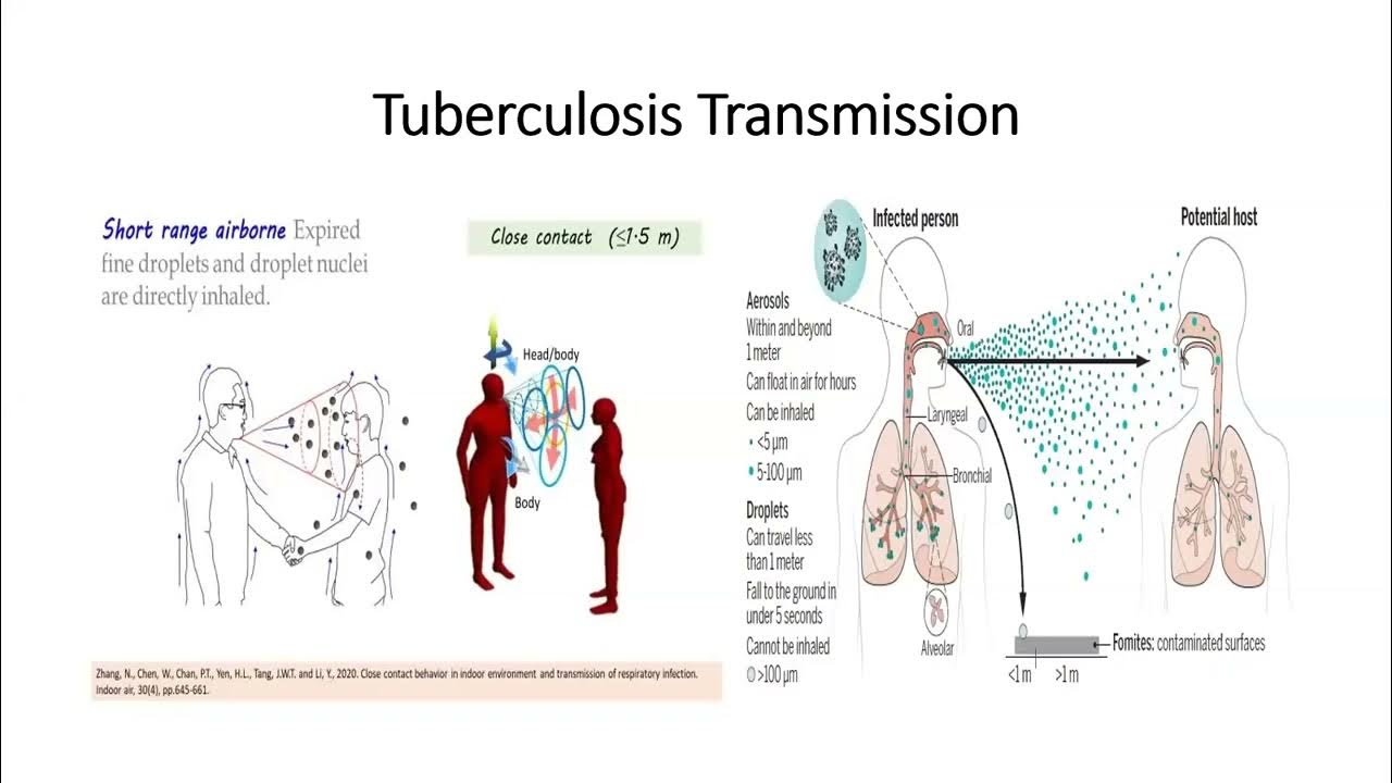 KNH-UoN Webinar : Infection Prevention & Control Practices in Tuberculosis Management - YouTube