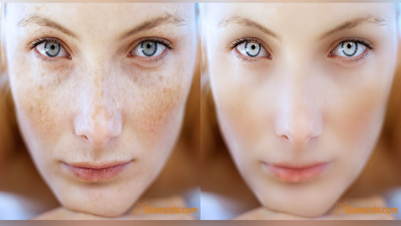 how to remove face pimples scares on photoshop skin blemishing - YouTube