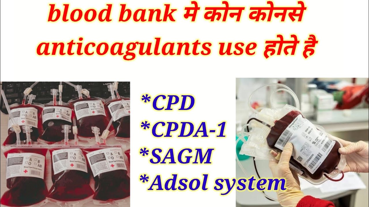 Anticoagulants used in blood banks/ blood bank m use hone vale ...