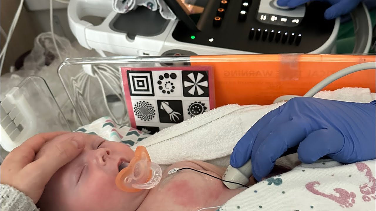 Echocardiogram for baby - YouTube