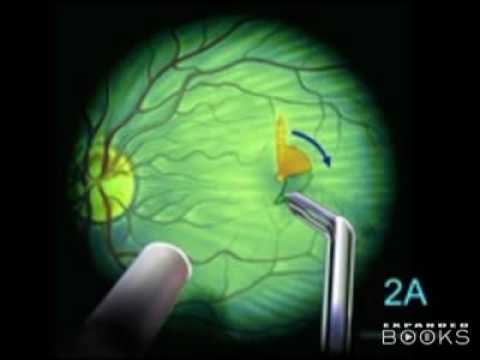 Routine Miracles with Dr. Conrad Fischer: Ophthamalology - YouTube