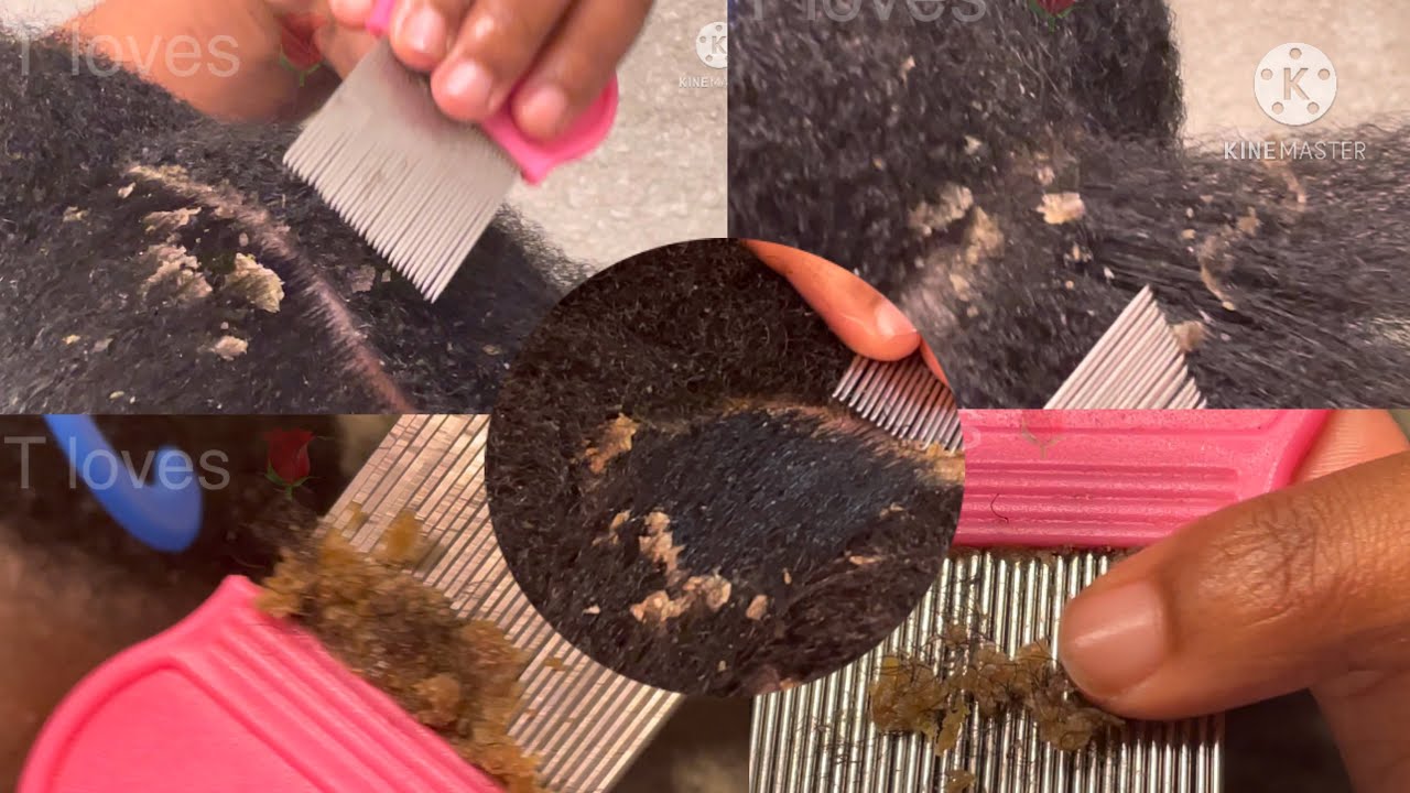 New scratch// hair is wayyyyy thicker 😖 - YouTube