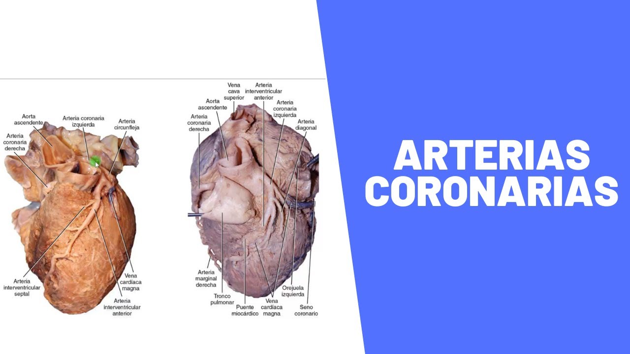 Arterias Coronarias(Disección del Corazón) - YouTube
