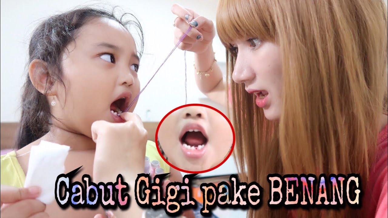 Cabut Gigi Pakai Benang!! HISTERIS!! || Marisha Chacha - YouTube