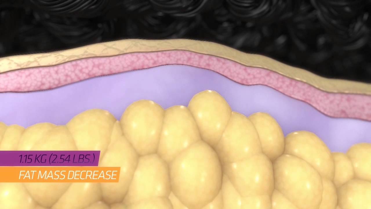 SEE AND FEEL THE DIFFERENCE WITH NILIT® INNERGY's COSMETIC BENEFITS ...