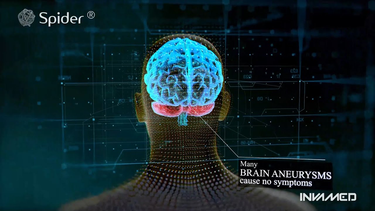 Spider®️ Detachable Coil Effect - YouTube