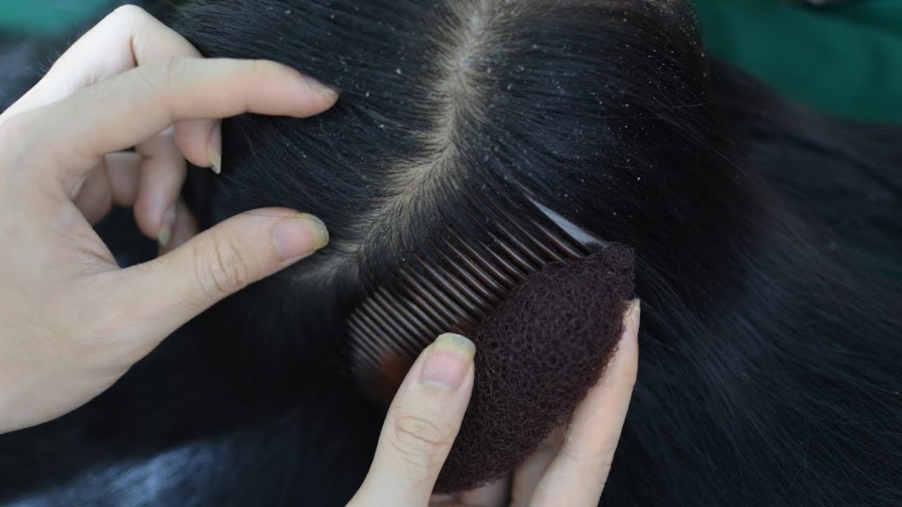 ASMR Scalp Scratching, Scalp Massage On Real Person With Comb Relaxing ...