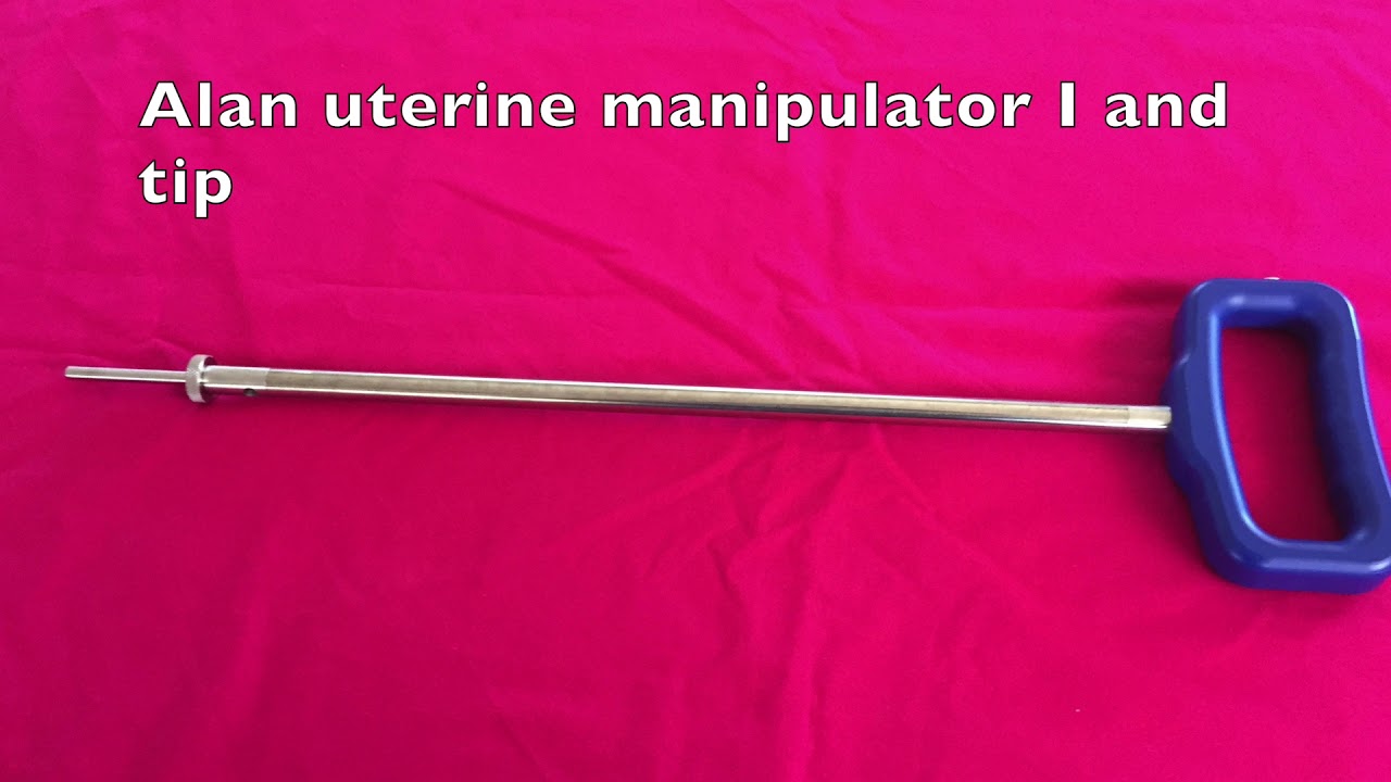 VIDEO 2: How to assemble and insert the Alan utero vaginal manipulator ...