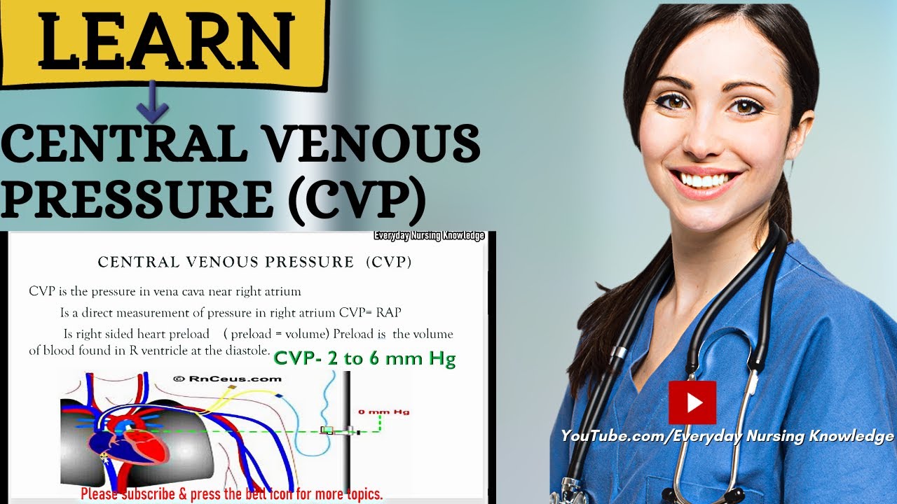 Learn about Central Venous Pressure (CVP) I Everyday Nursing Knowledge ...