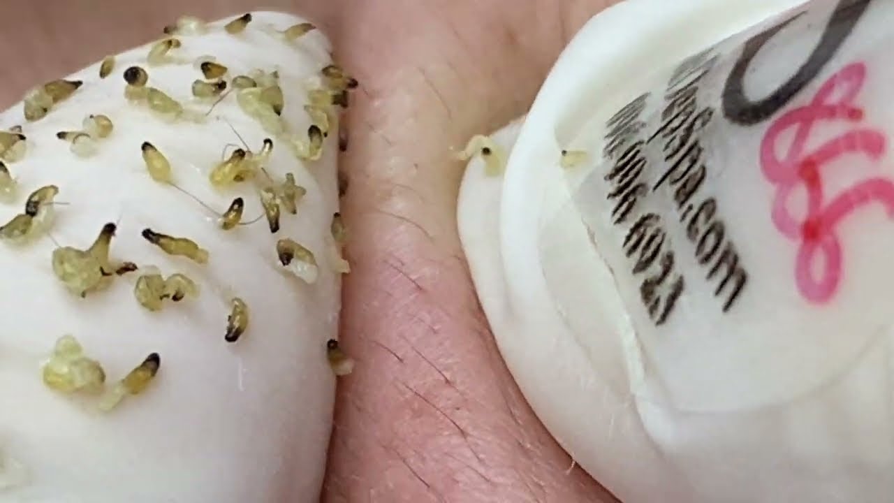 Koi Fish | 𝐄𝐧𝐣𝐨𝐲 𝐭𝐡𝐞 𝐬𝐮𝐫𝐩𝐫𝐢𝐬𝐞 𝐟𝐫𝐨𝐦 𝐒𝐚𝐜 𝐃𝐞𝐩 𝐒𝐩𝐚 𝐍𝐞𝐰 𝐕𝐢𝐝𝐞𝐨𝐬 2022 #0381 ...