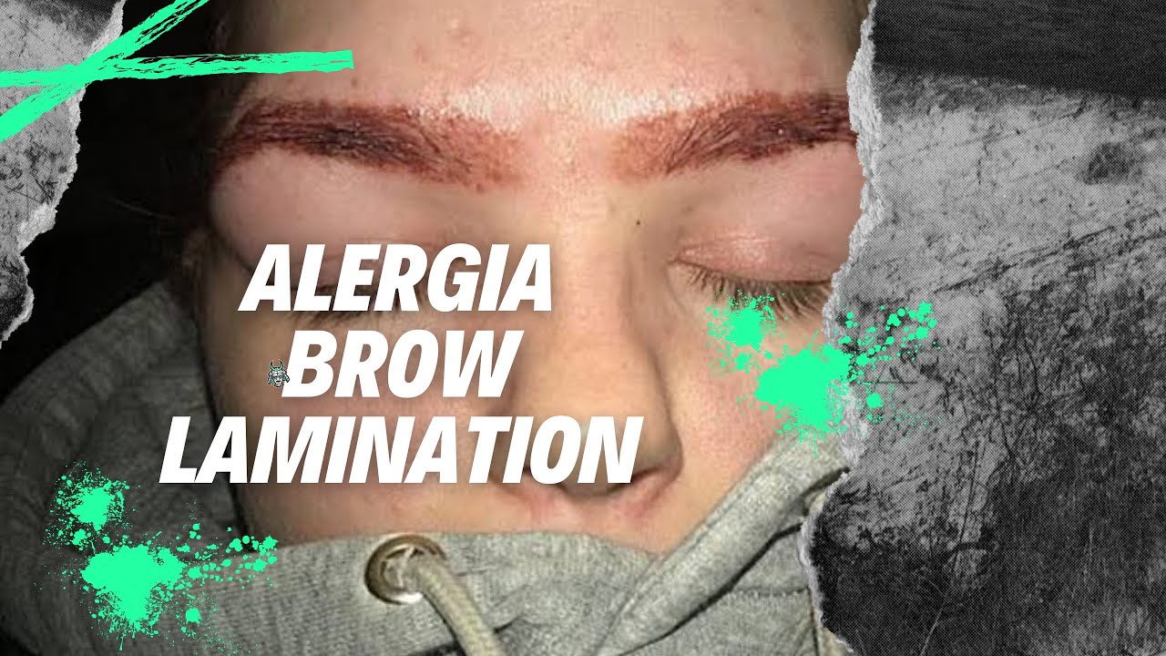 Alergia e Brow lamination - YouTube