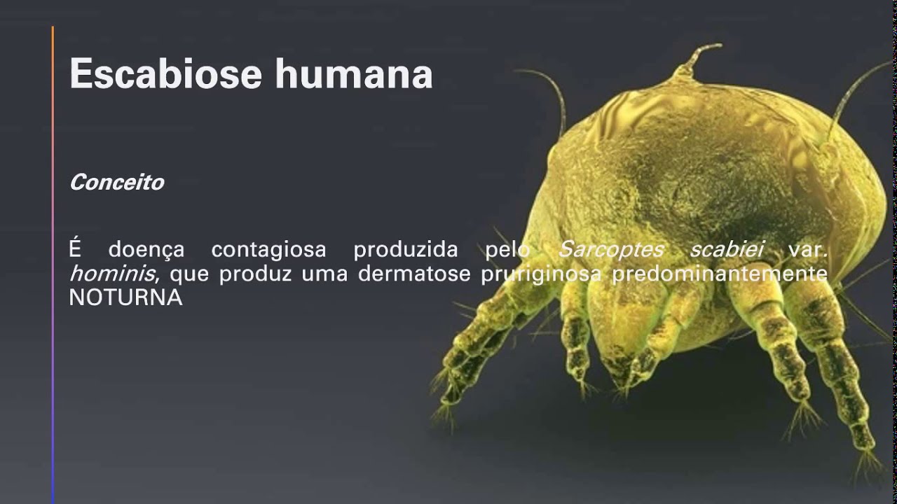 ESCABIOSE (SARNA), epidemiologia e etiopatogenia. PARTE I - YouTube