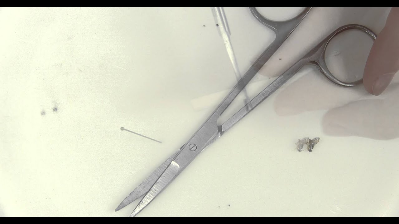 Double Mounting with Micropin Pinning Technique - YouTube