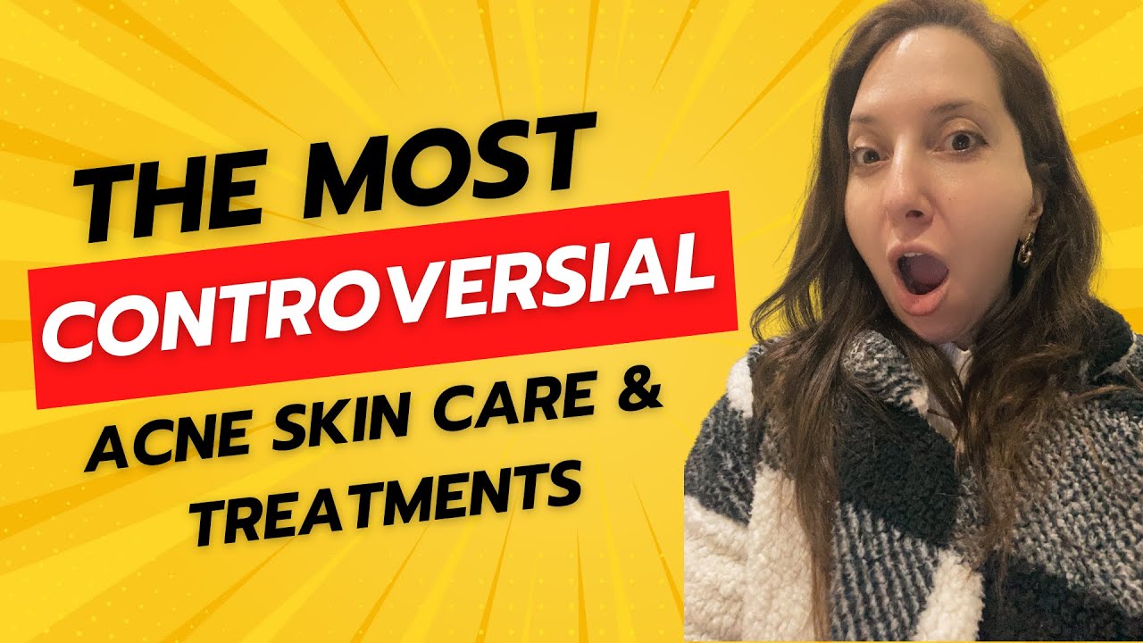 How to get rid of Acne forever - YouTube