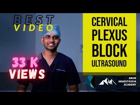 CERVICAL PLEXUS BLOCK INTERMEDIATE AND SUPERFICIAL ULTRASOUND GUIDED / UPDATE MYTHS IN ...