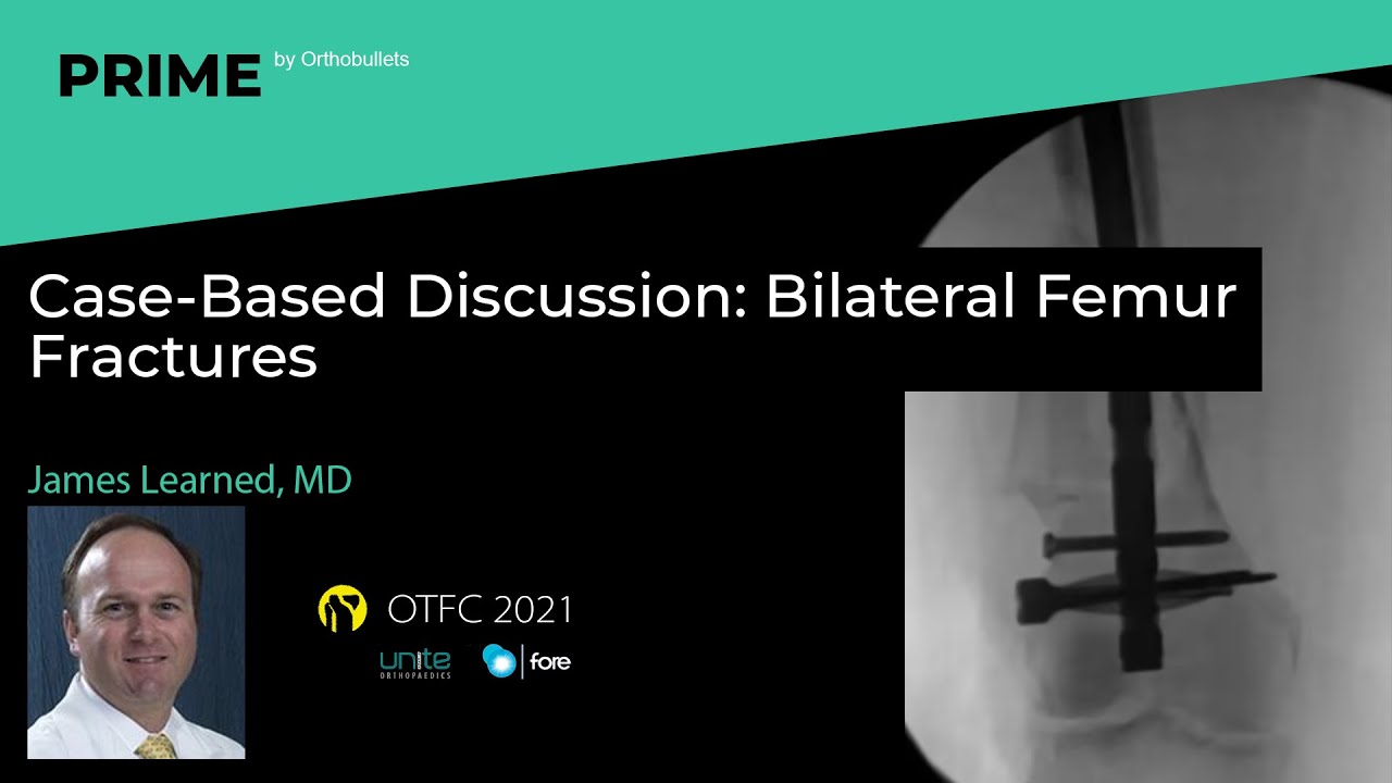 Case-Based Discussion: Bilateral Femur Fractures - James Learned, MD ...