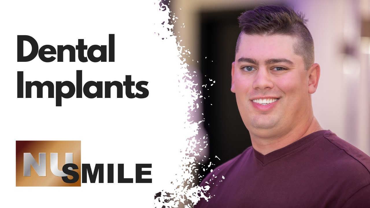 I Was Tired Of Being In Pain & Shame, Dental Implants Changed My Life ...