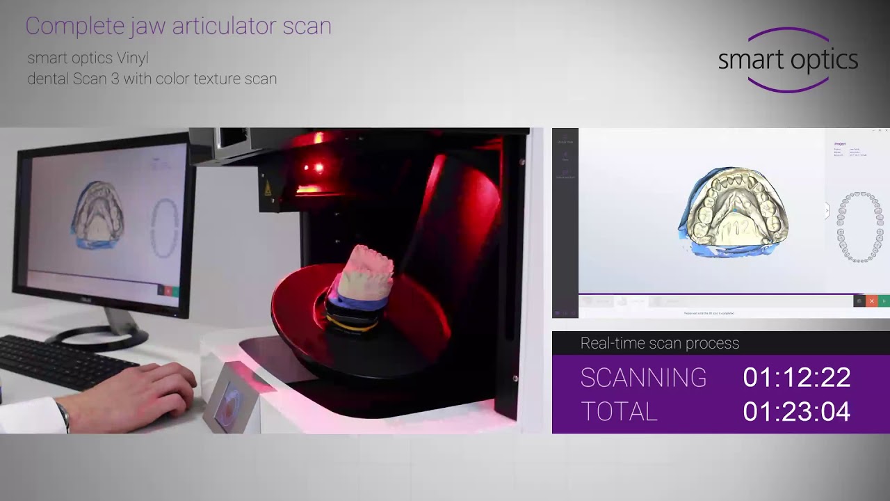 vinyl ds3 complete jaw articulator scan eng smartoptics - YouTube