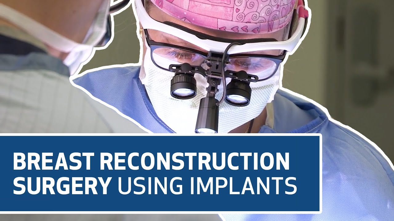 Advanced Breast Implant Reconstruction: Pre-Pectoral Technique ...