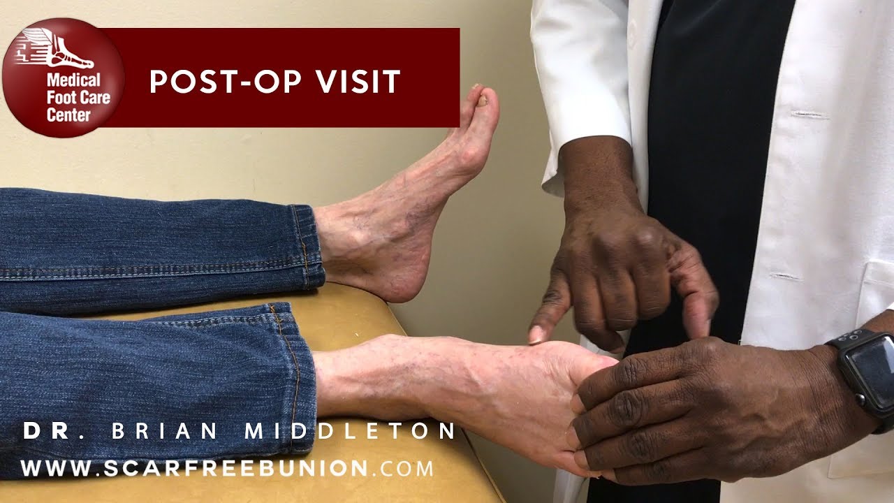 Post-Op Visit | Minimal Invasive Foot Surgery | Medical Foot Care ...