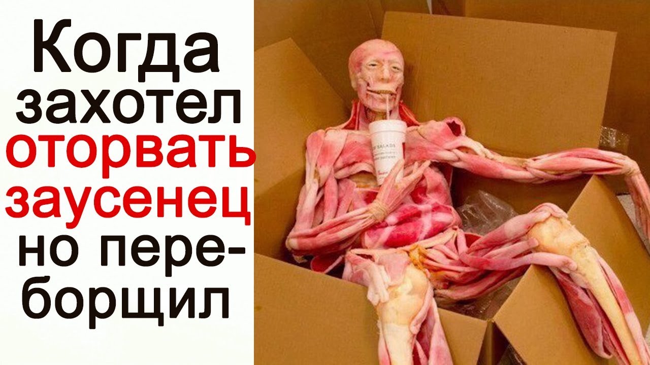 Лютые Приколы Когда захотел оторвать заусенец но переборщил угарные мемы Youtube