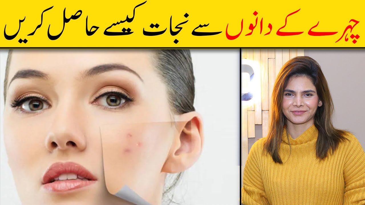 How To Remove Pimples Acne Treatment Chehre Ke Dano Asan Ka Ilaj