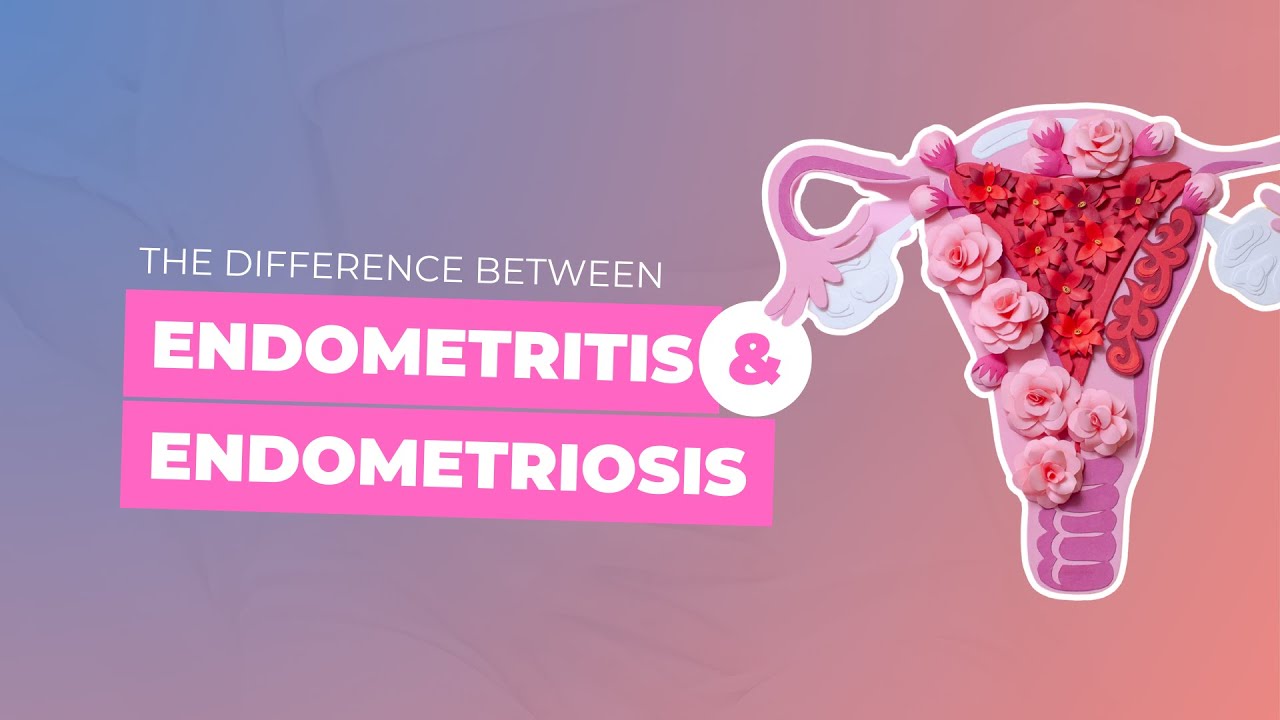 What is the difference between endometritis and endometriosis? - YouTube