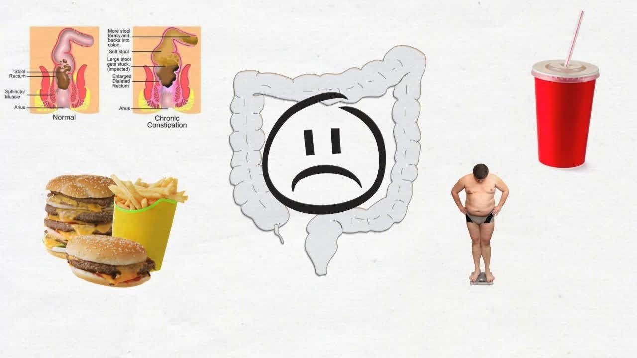 Clear liquid diarrhea - YouTube