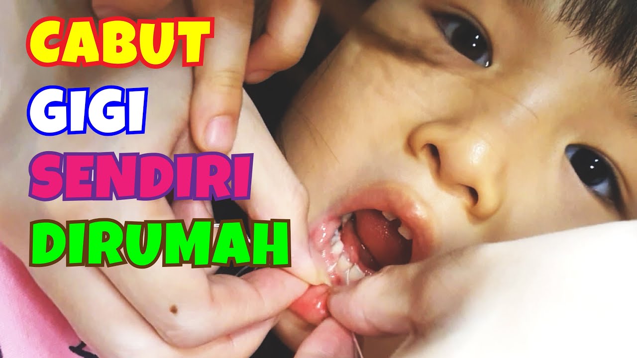 Cabut Gigi Sendiri Dirumah - Mommy Cisca jadi Dokter Gigi - YouTube
