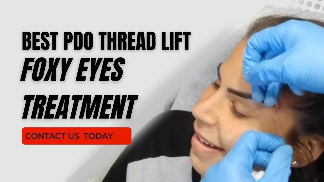 Foxy Eyes Thread Lift in West Palm Beach | Best PDO Thread Lift in West ...