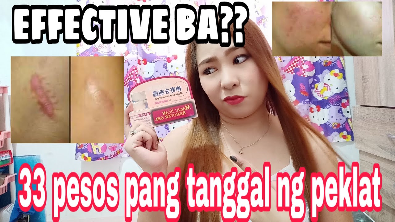 MAGIC SCAR REMOVER GEL REVIEW | 33 pesos lang tanggal peklat na?? - YouTube