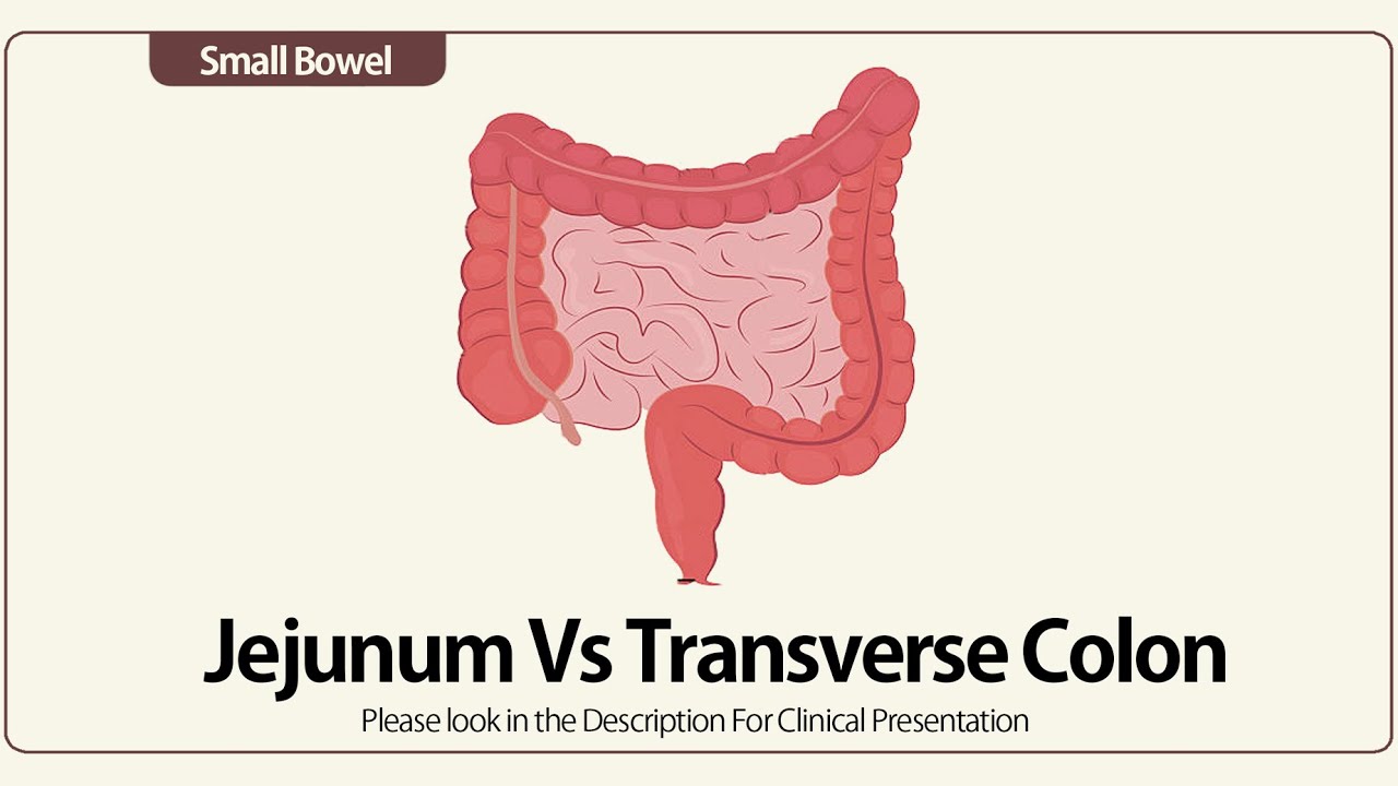 Linear EUS: Jejunum Vs Transverse Colon - YouTube